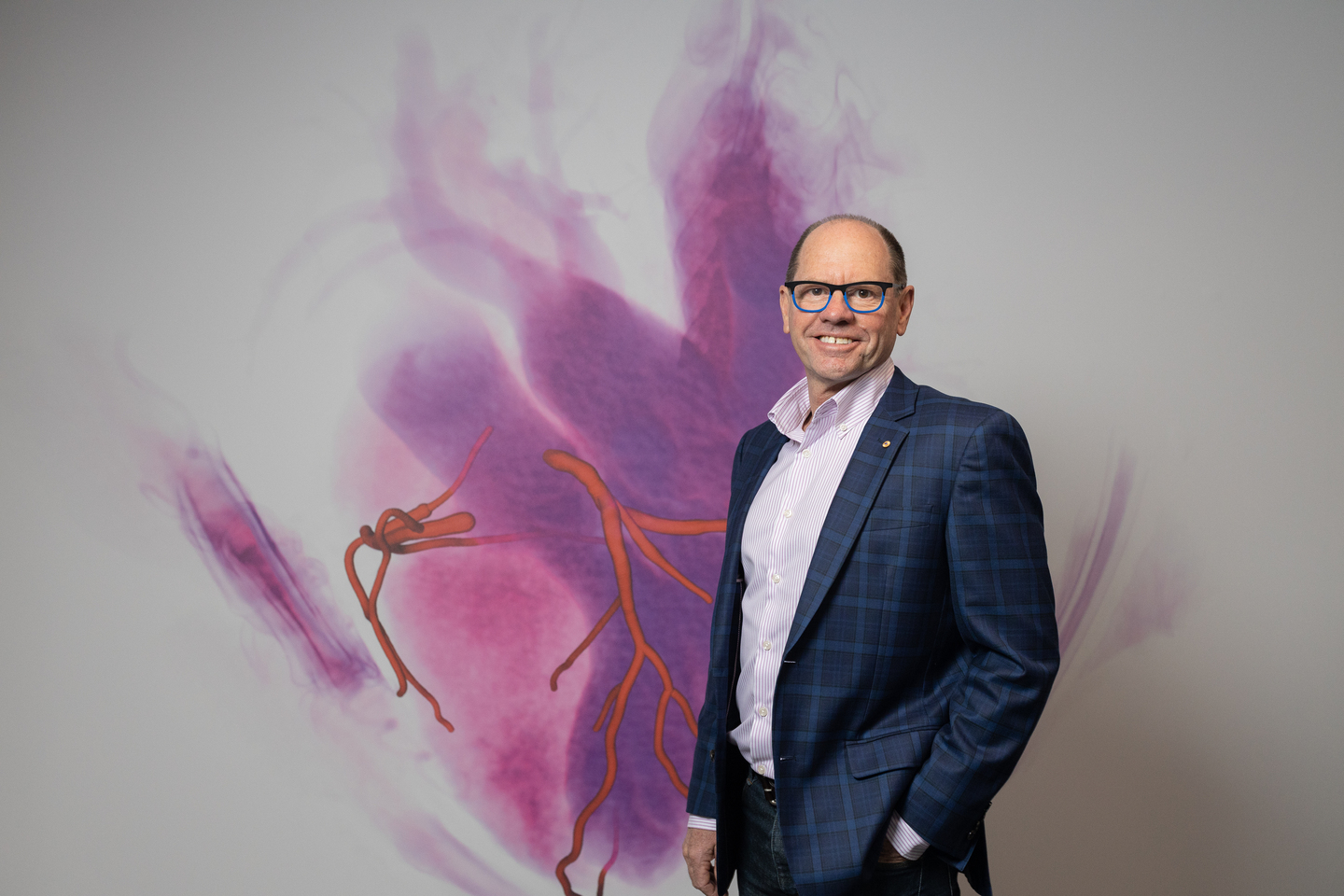 Medtech Artrya breaks into UK market